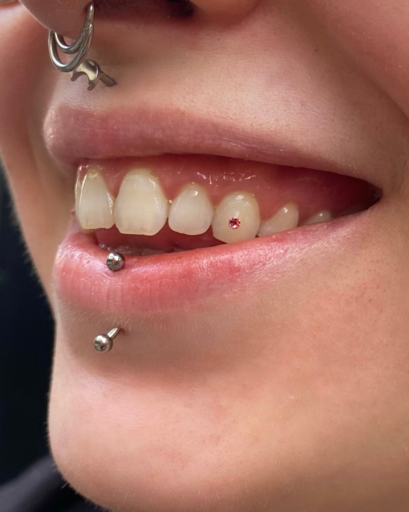 Tooth Gems – PIERCED Online Piercing Jewellery Store